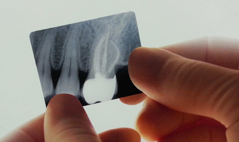 Oral and maxillofacial radiology - JCD Dental College